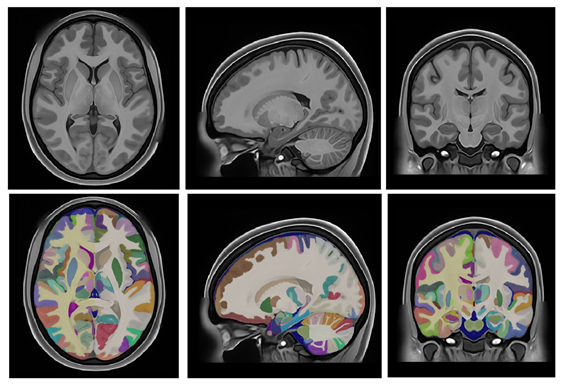 ITACA-UPV researchers develop one of the most detailed brain atlases in ...